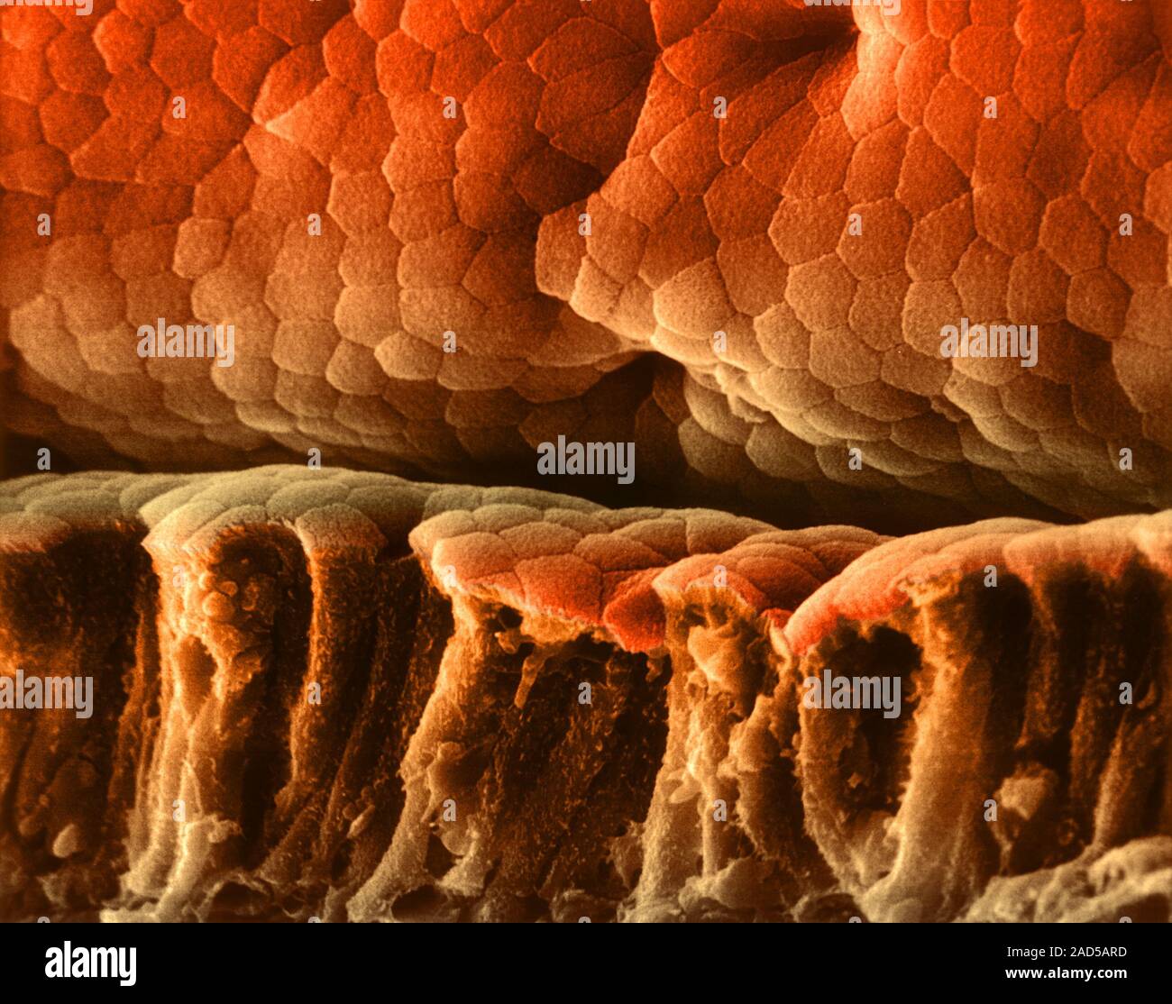 Villus surface of the small intestine; columnar epithelial cells ...