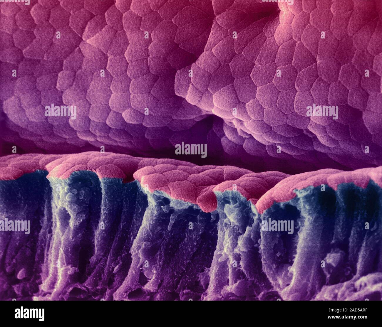 Villus surface of the small intestine; columnar epithelial cells ...
