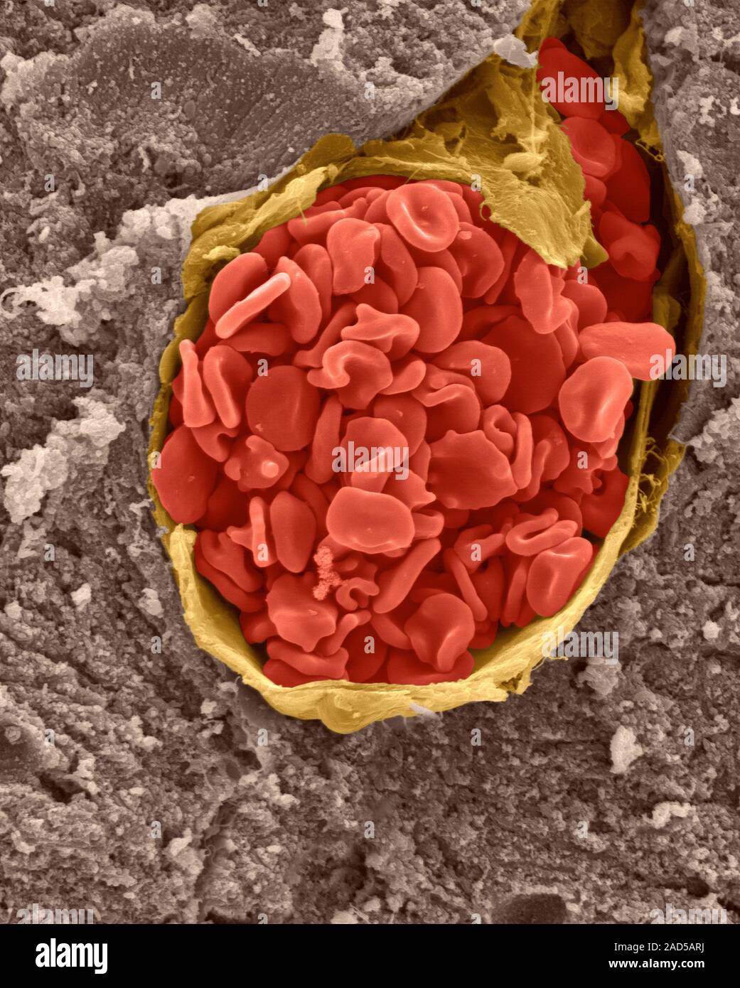Arteriole in the human cerebellum containing red blood cells, coloured ...