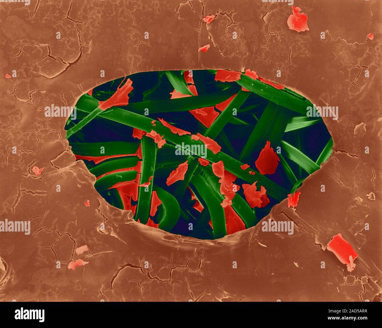 Band-aid inner surface with dried blood on the absorbent fibres ...