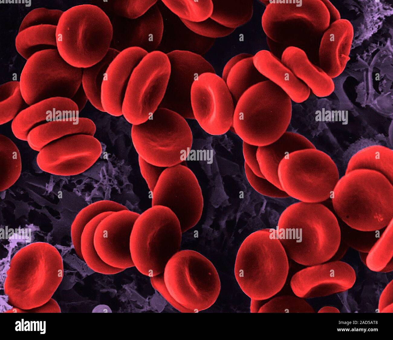 Human red blood cells in physiological isotonic saline solution (0.9% ...