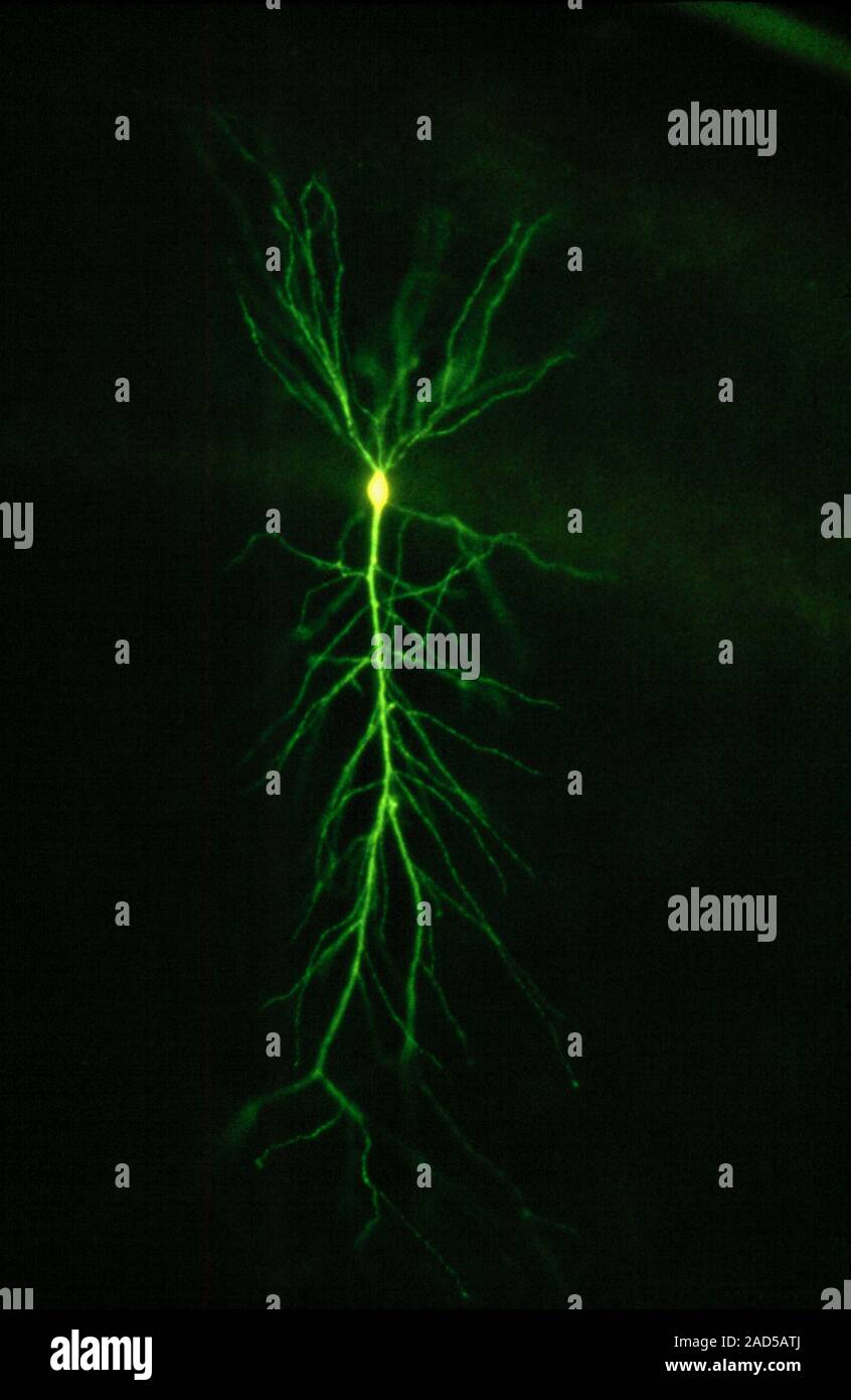 Fluorescence light micrograph of a pyramidal neuron (pyramidal nerve ...
