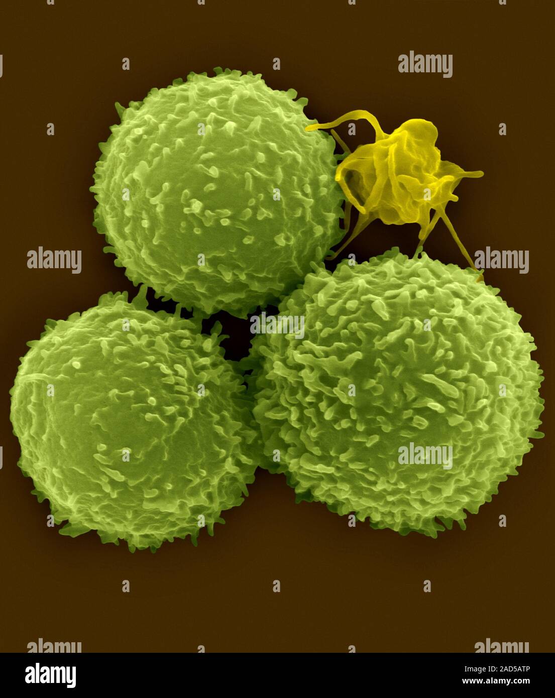 Human T lymphocytes (pre-T cells) and activated platelet, coloured ...