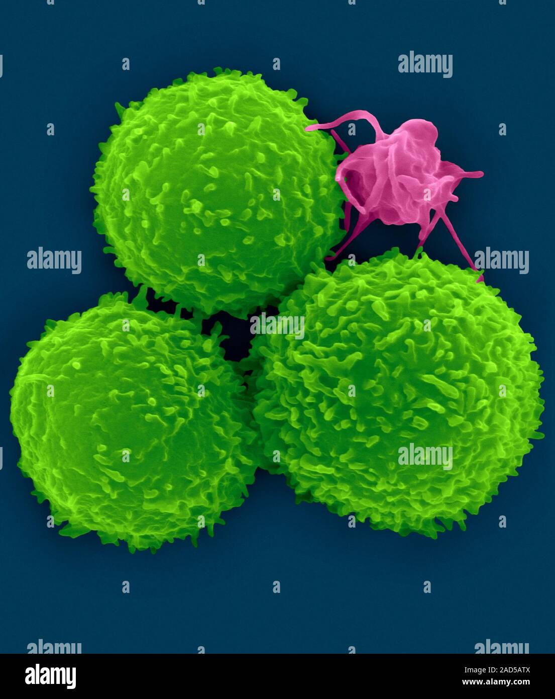 Human T lymphocytes (pre-T cells) and activated platelet, coloured ...