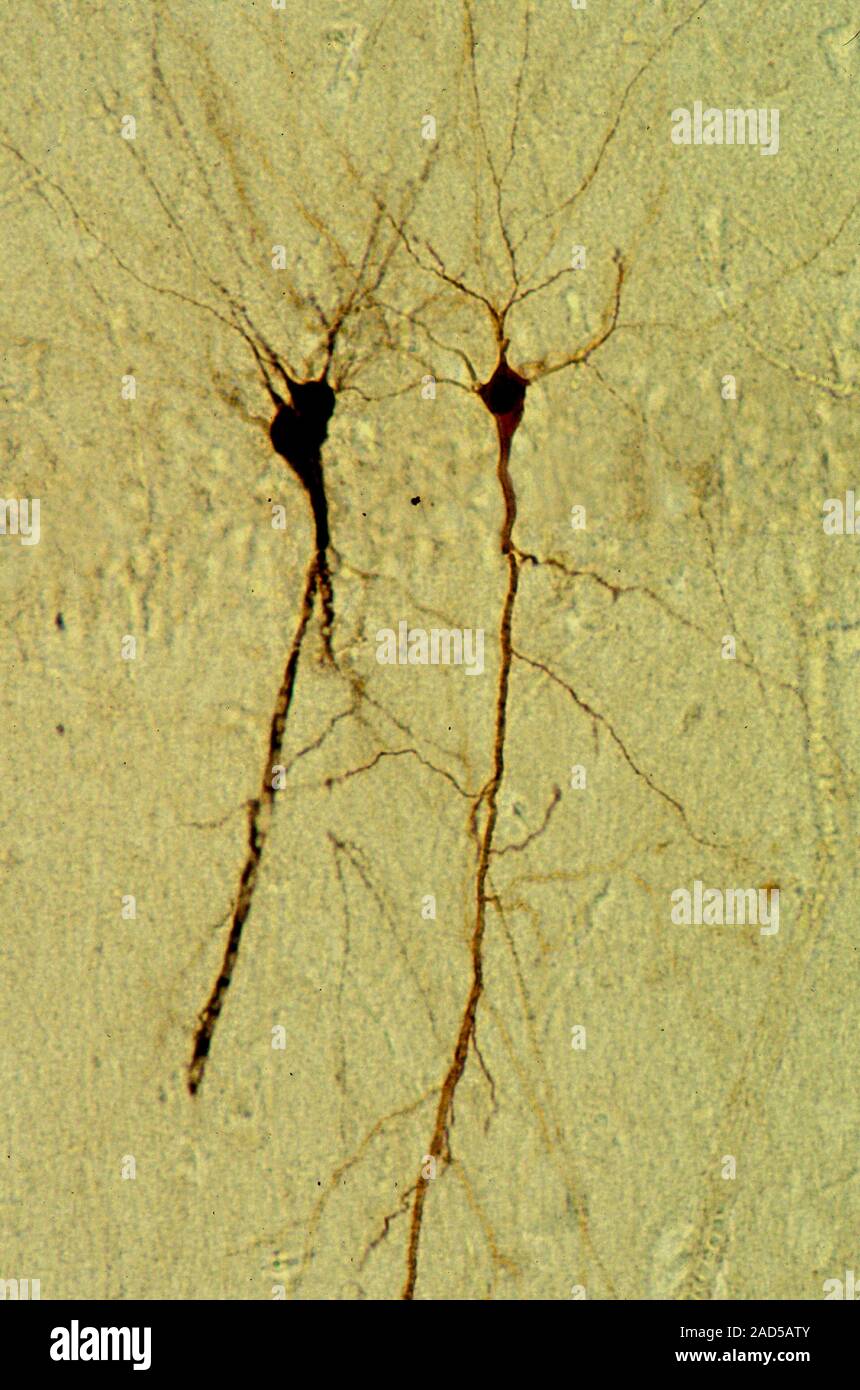 Brightfield light micrograph of pyramidal neurons (pyramidal nerve ...
