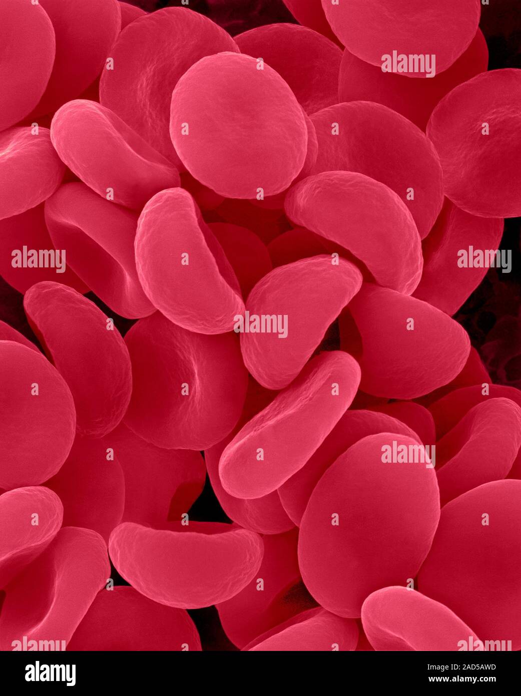 Human red blood cells in hypotonic solution (0.65% NaCl), coloured ...