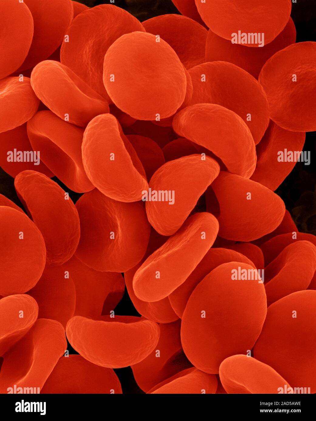 Human red blood cells in hypotonic solution (0.65% NaCl), coloured ...