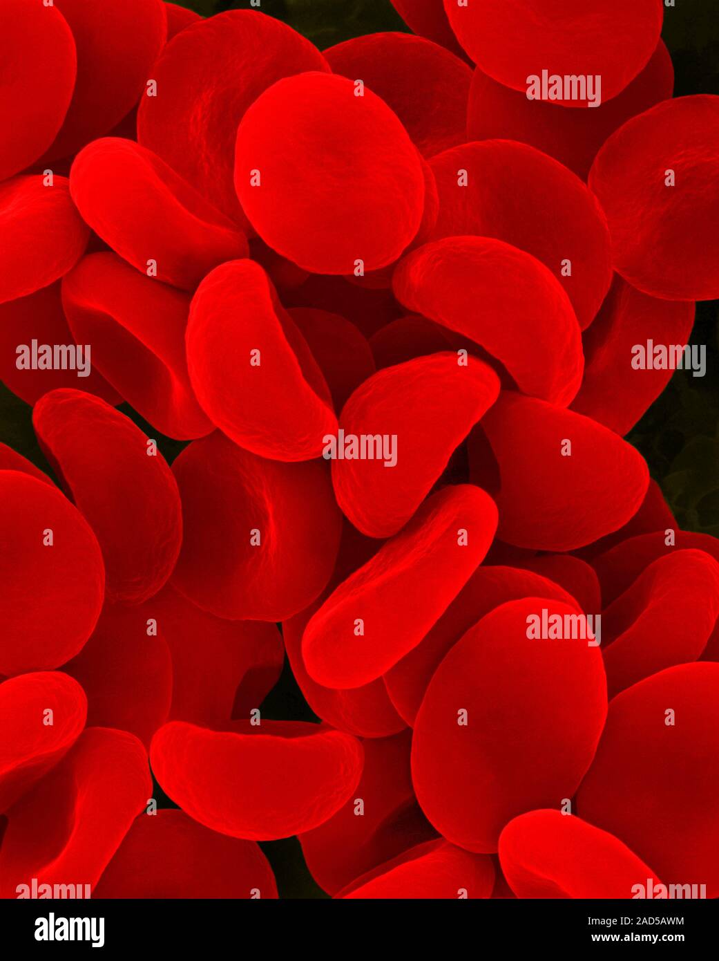 Human red blood cells in hypotonic solution (0.65% NaCl), coloured ...