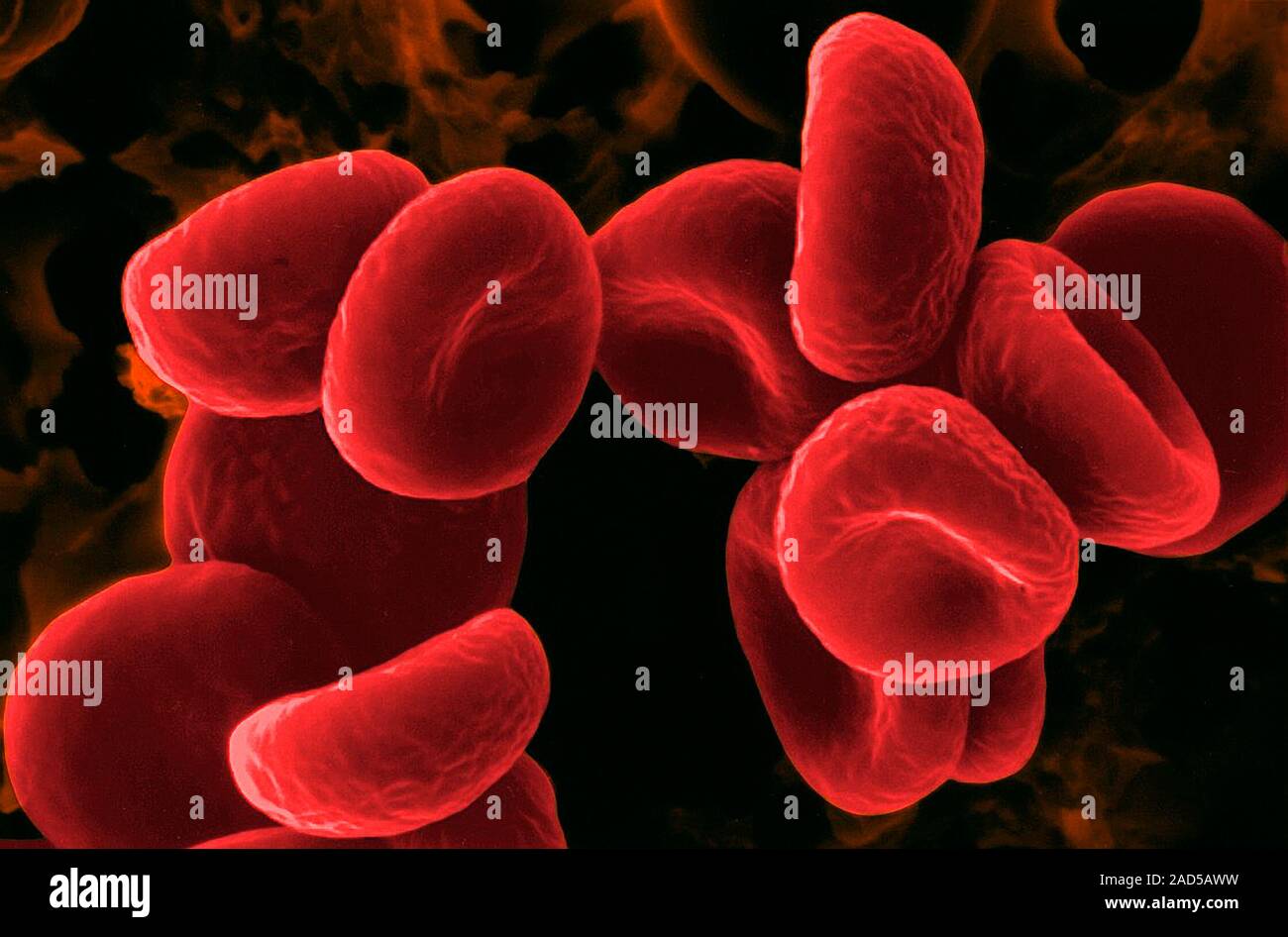 Human red blood cells in hypotonic solution (0.65% NaCl), coloured ...