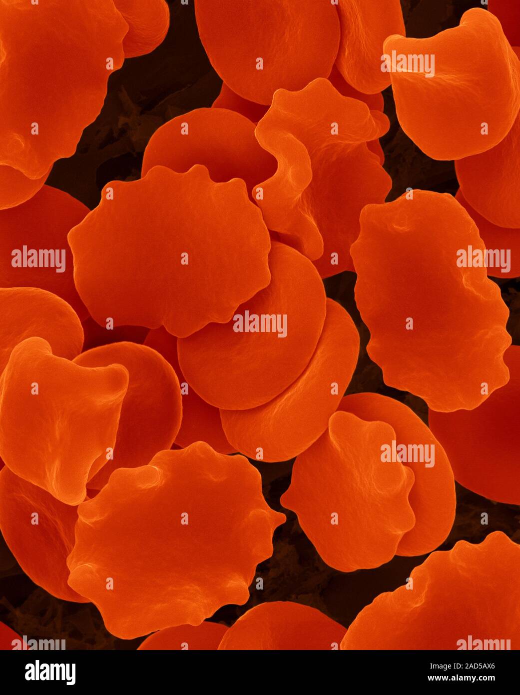 Human red blood cells in hypertonic solution (1.01% NaCl), coloured ...