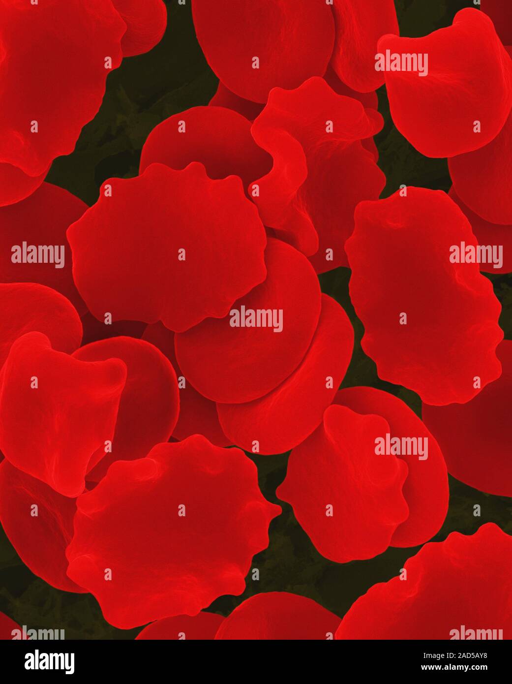 Human red blood cells in hypertonic solution (1.01% NaCl), coloured ...