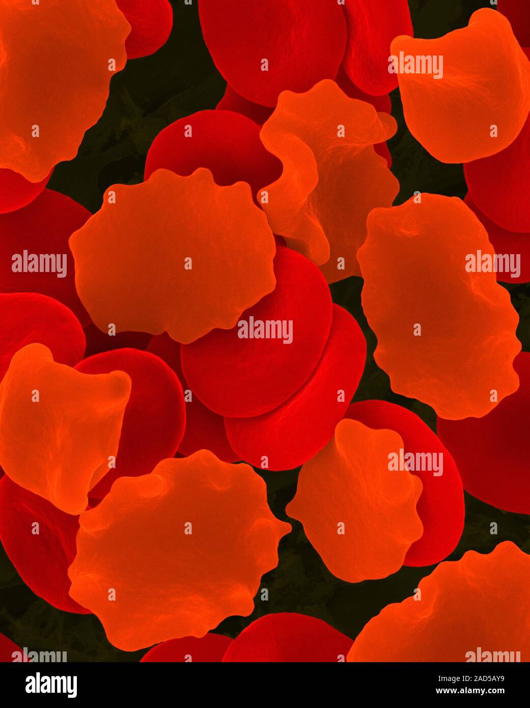 Human red blood cells in hypertonic solution (1.01% NaCl), coloured ...