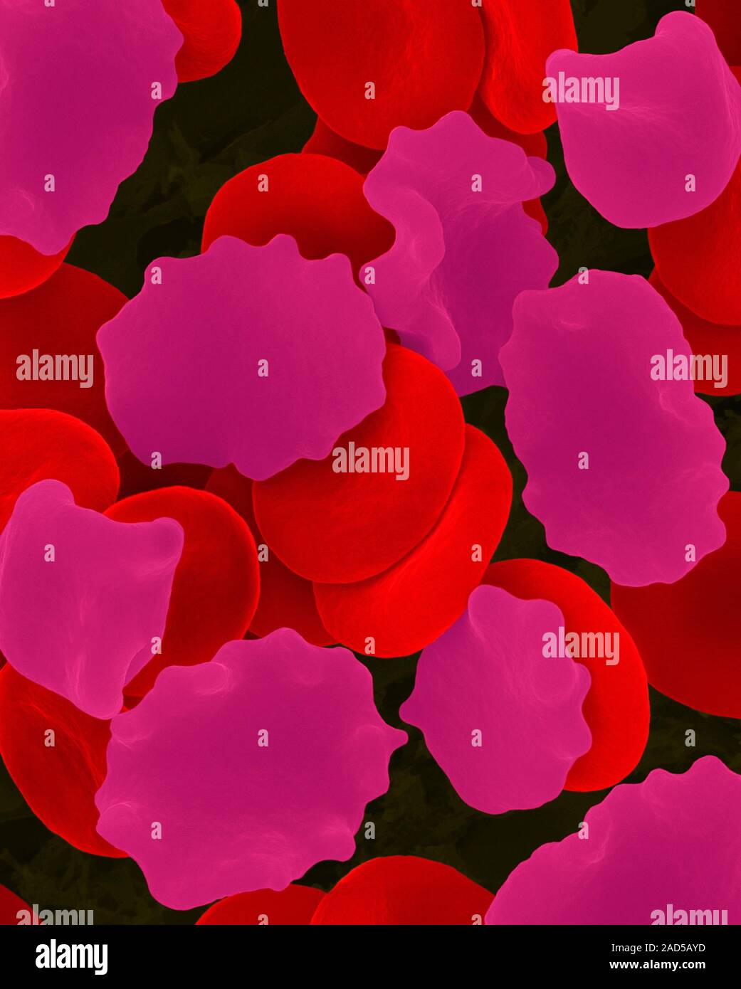 Human red blood cells in hypertonic solution (1.01% NaCl), coloured ...