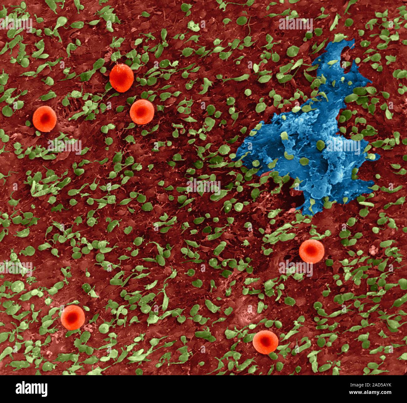 Blood vessel endothelial cell surface after angioplasty (balloon ...