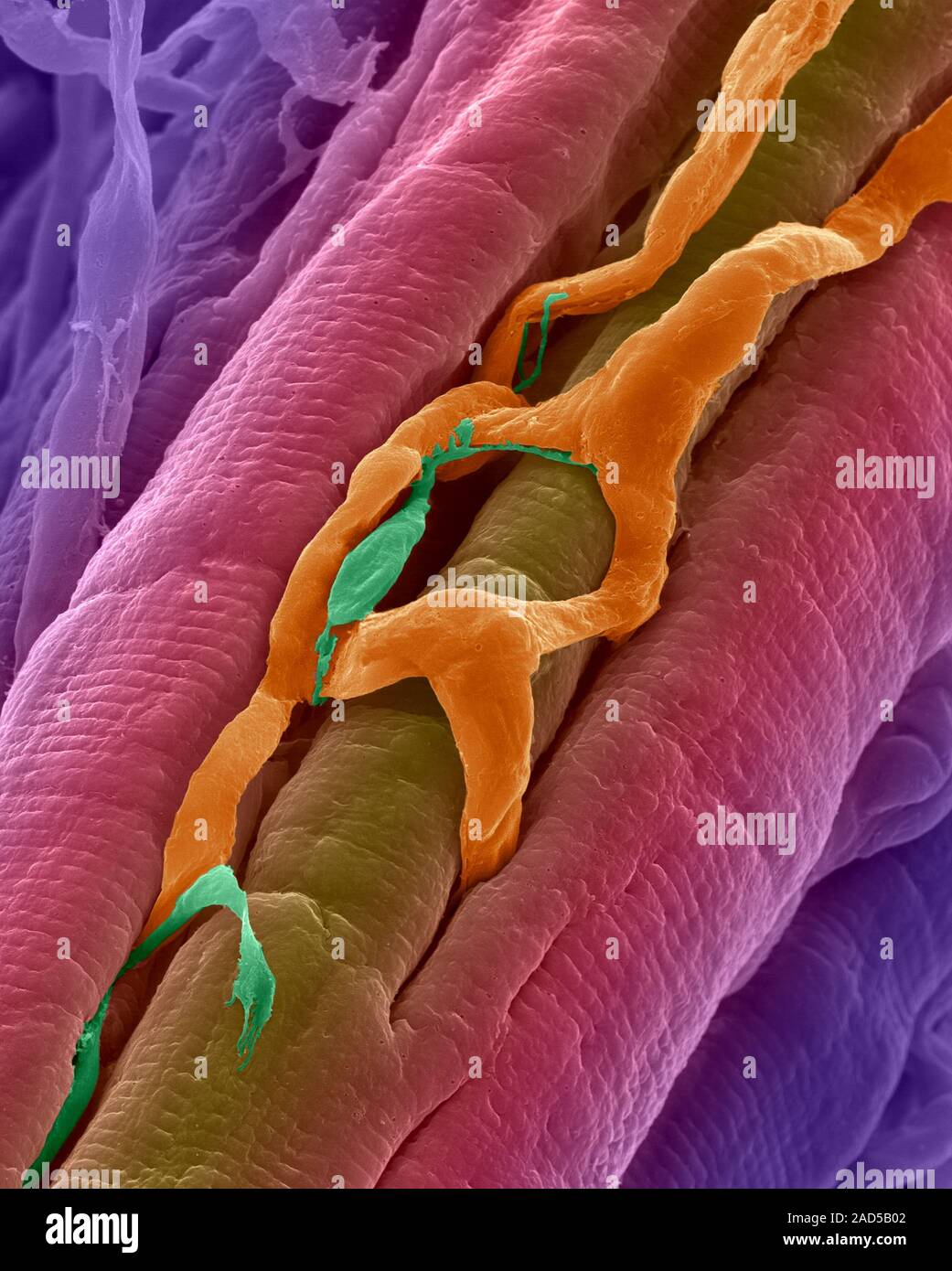 Heart muscle with capillaries passing amongst the heart muscle fibres ...