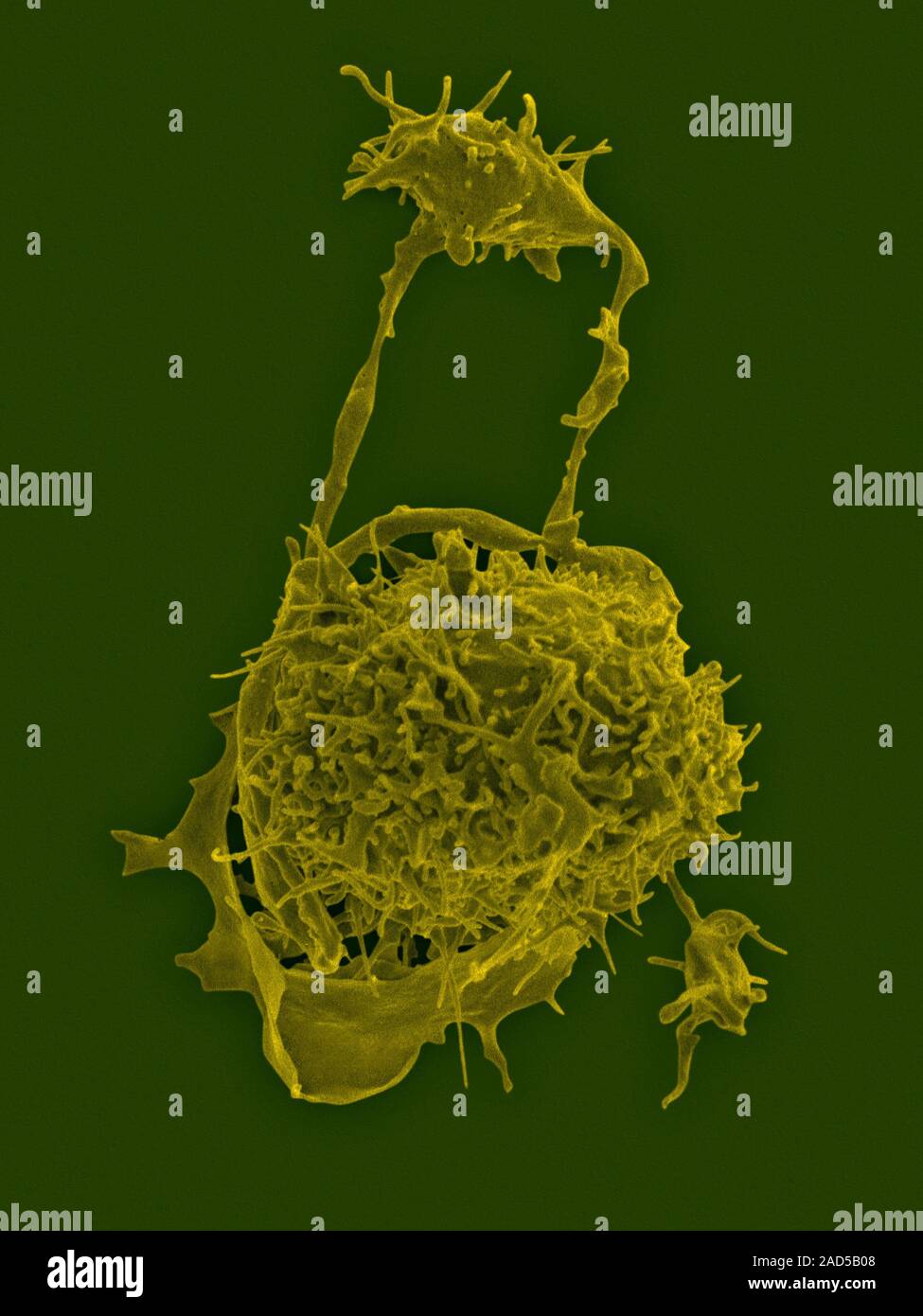 Human bone marrow megakaryocyte and platelet formation, coloured ...
