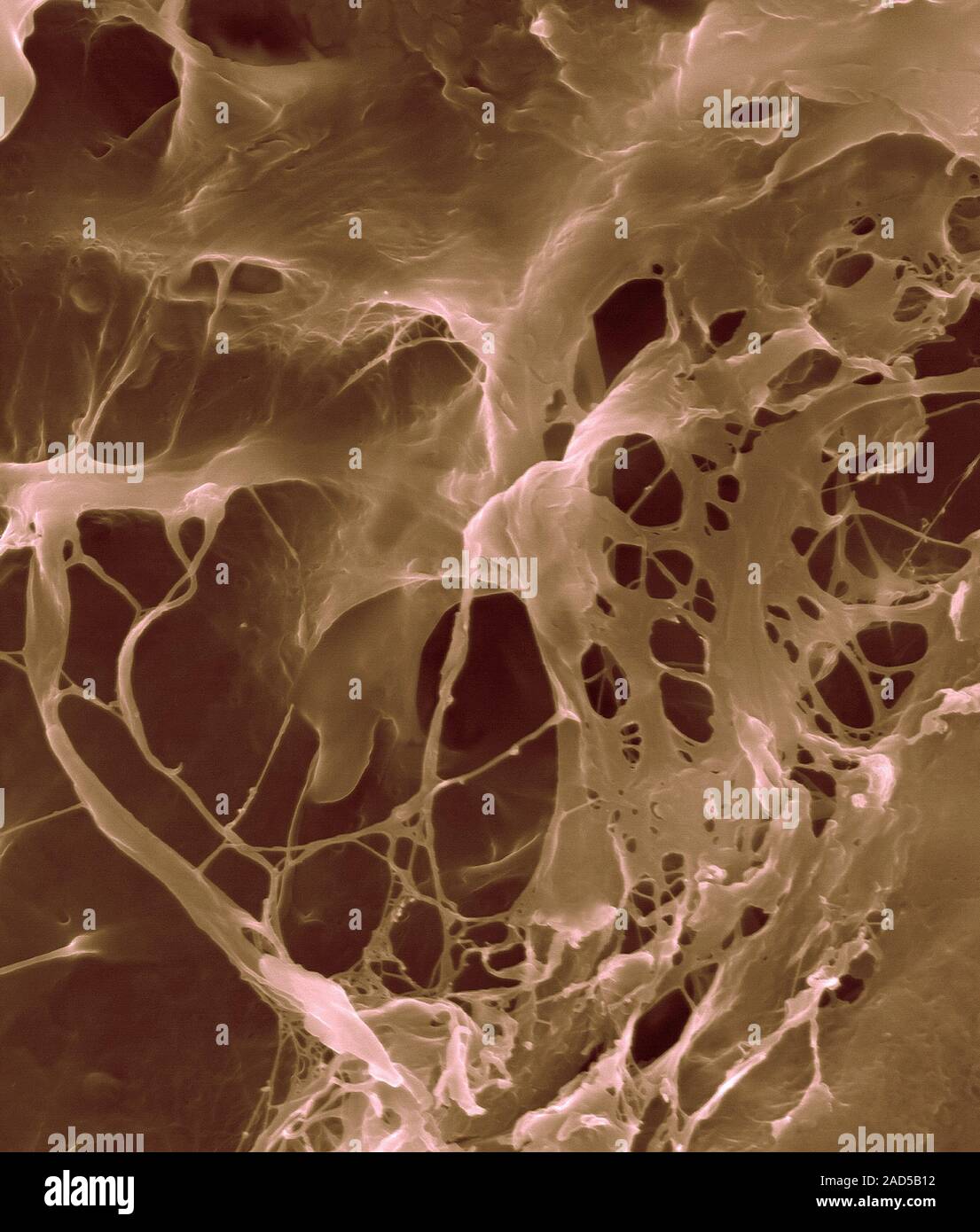 Extracellular matrix (ECM) produced by dermal fibroblasts, coloured ...