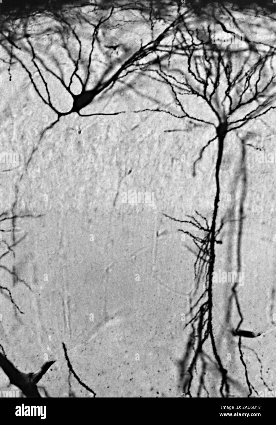 Brightfield light micrograph of interneuron (left) and pyramidal neuron ...