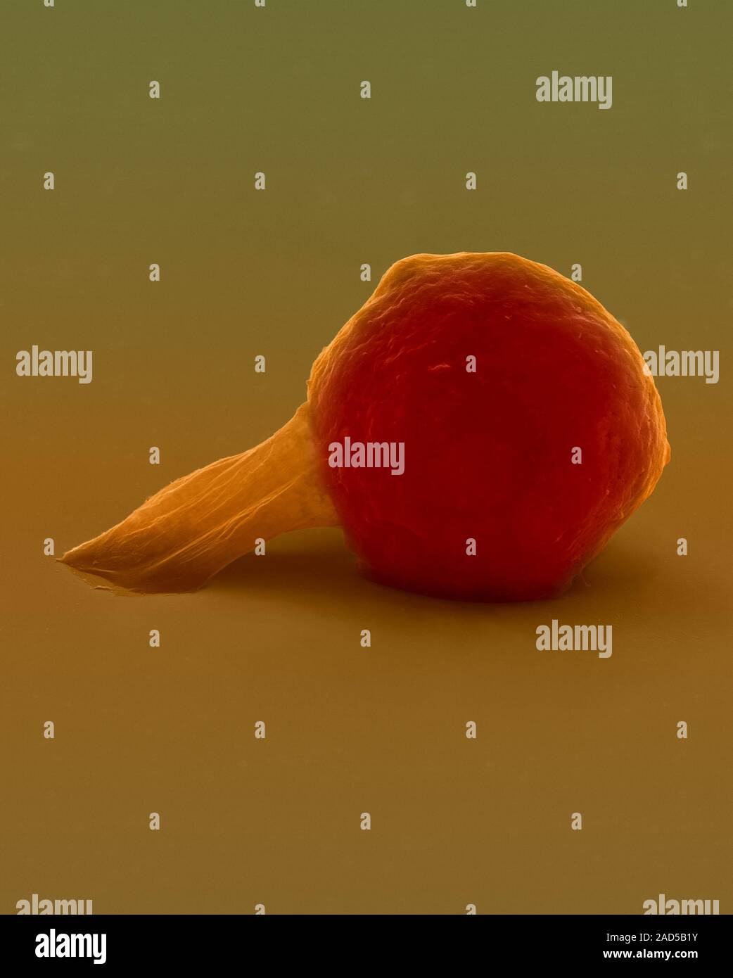 Muscle myoblast (primitive embryonic muscle cell) secreting ...