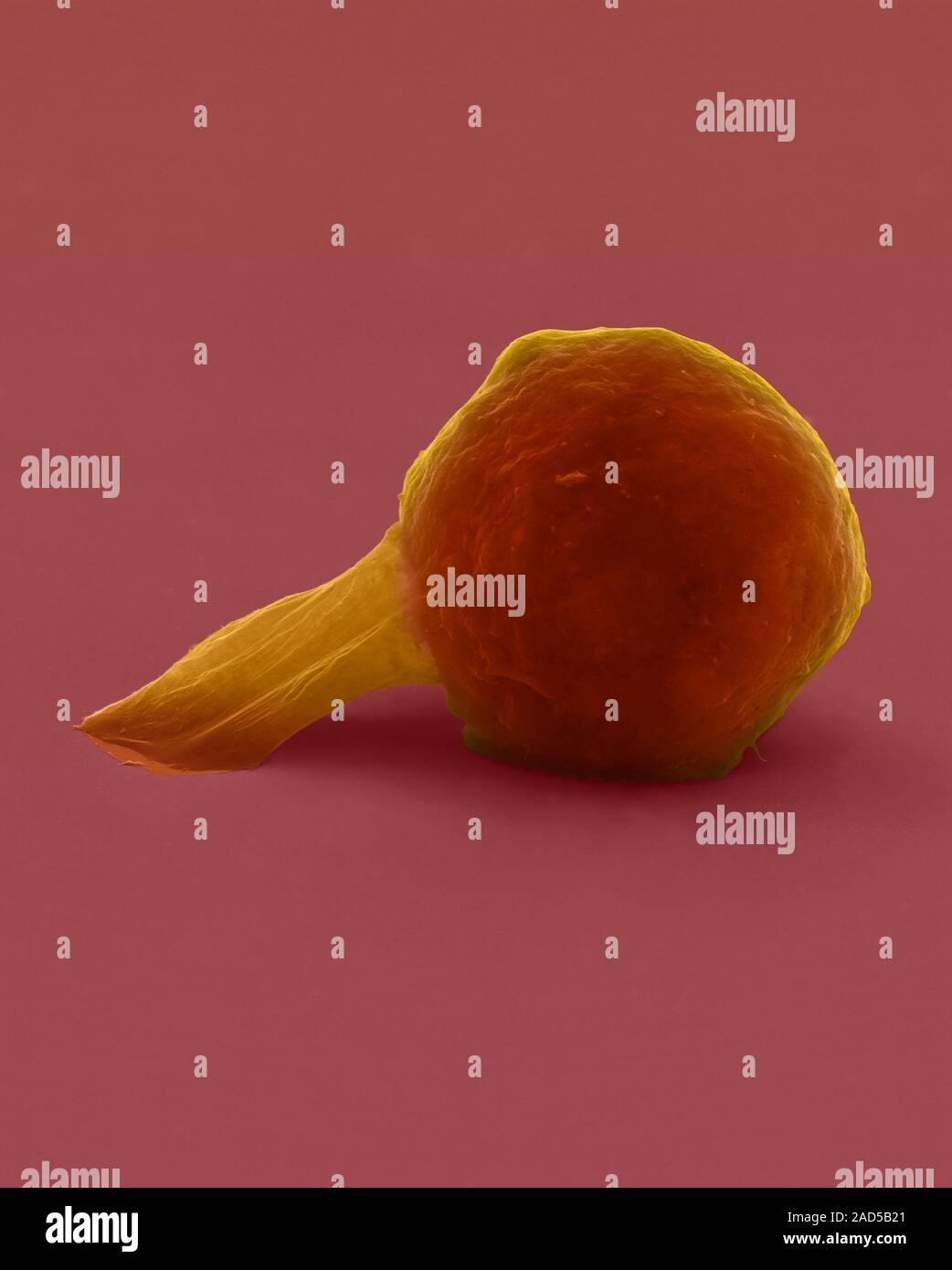 Muscle myoblast (primitive embryonic muscle cell) secreting ...