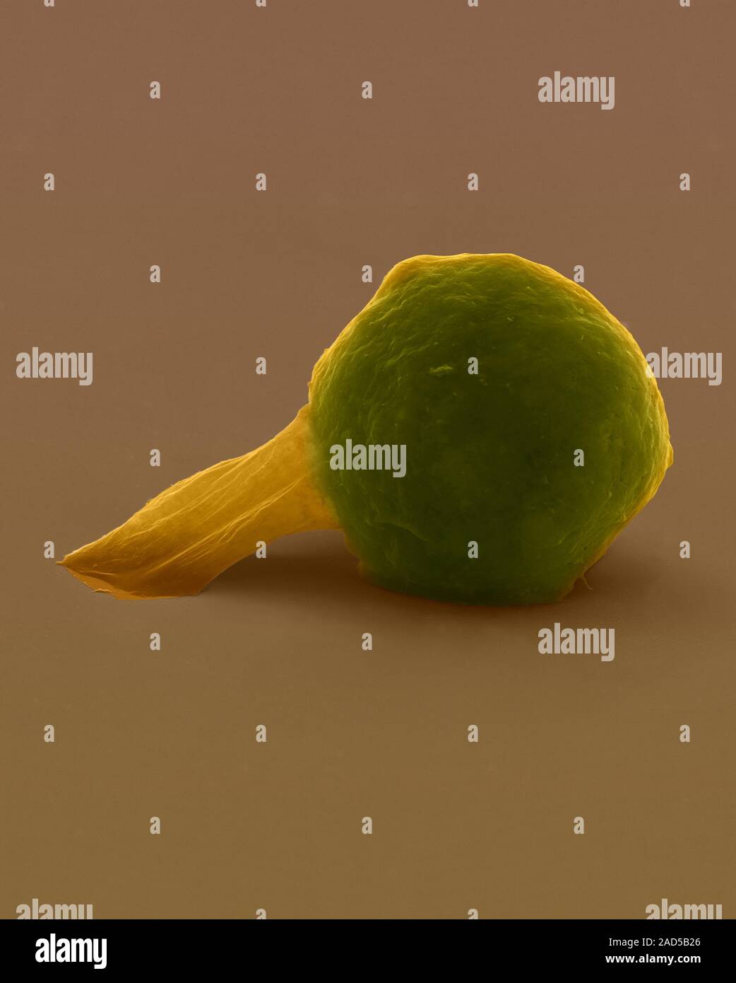 Muscle myoblast (primitive embryonic muscle cell) secreting ...