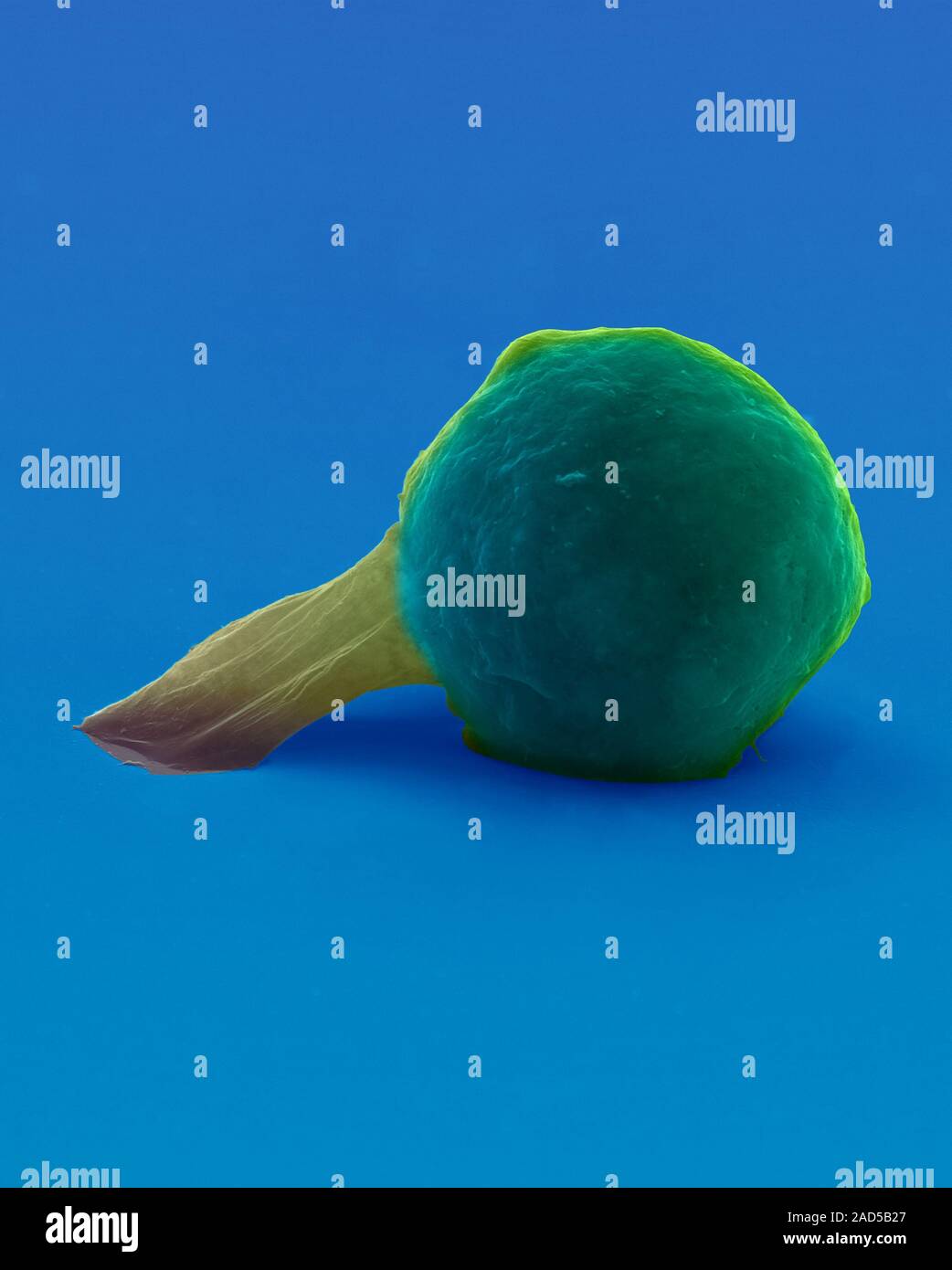 Muscle myoblast (primitive embryonic muscle cell) secreting ...