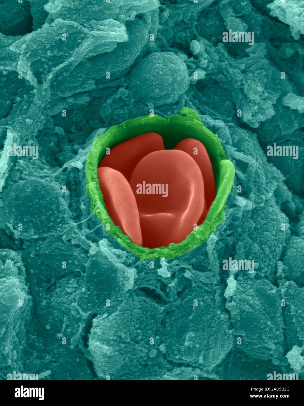 Human red blood cells in a capillary (human cerebellum), coloured ...