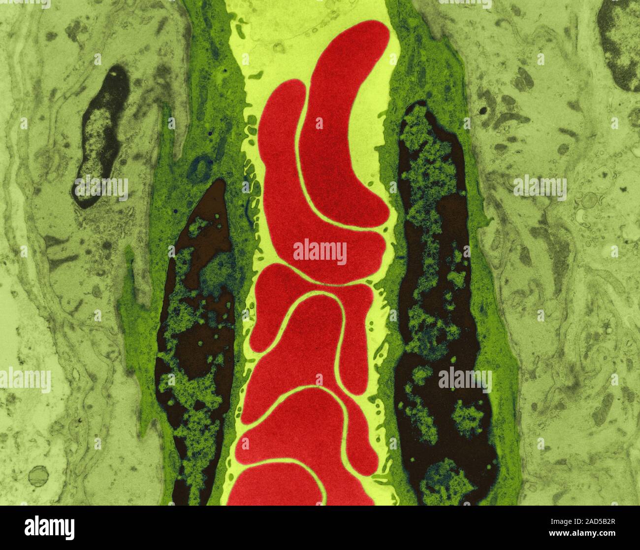 Red blood cells in a capillary (human central nervous system), coloured ...