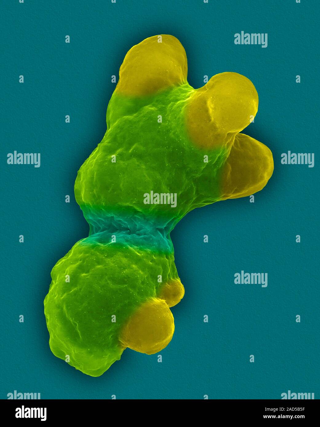 Entamoeba histolytica, dividing trophozoite with lobopodial extensions, coloured scanning ...