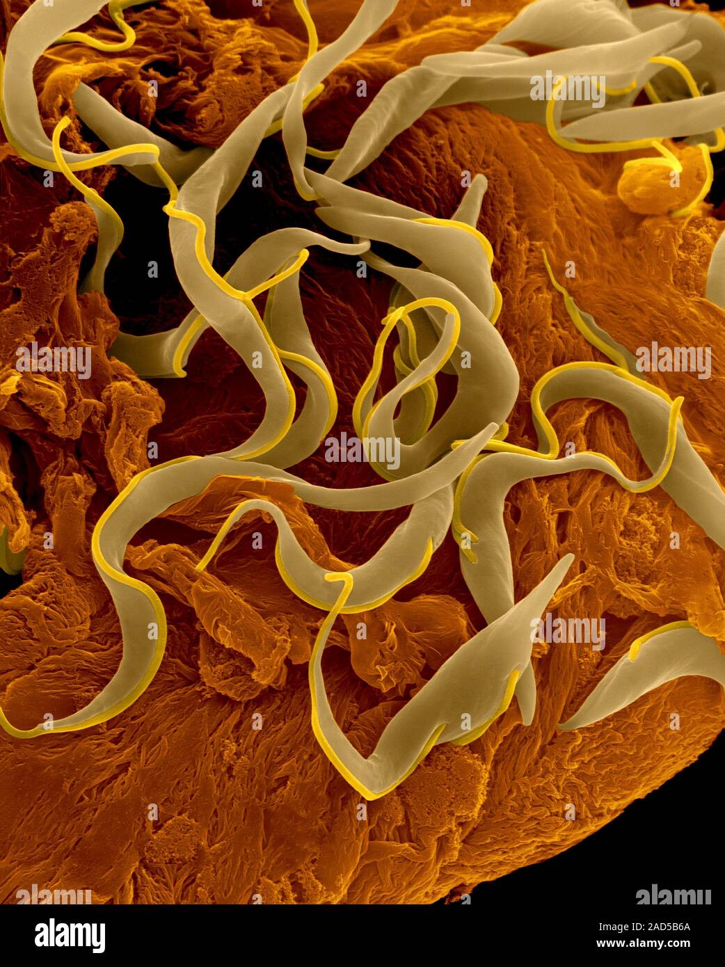 Trypanosome trypomastigote (Trypanosoma sp.), coloured scanning ...