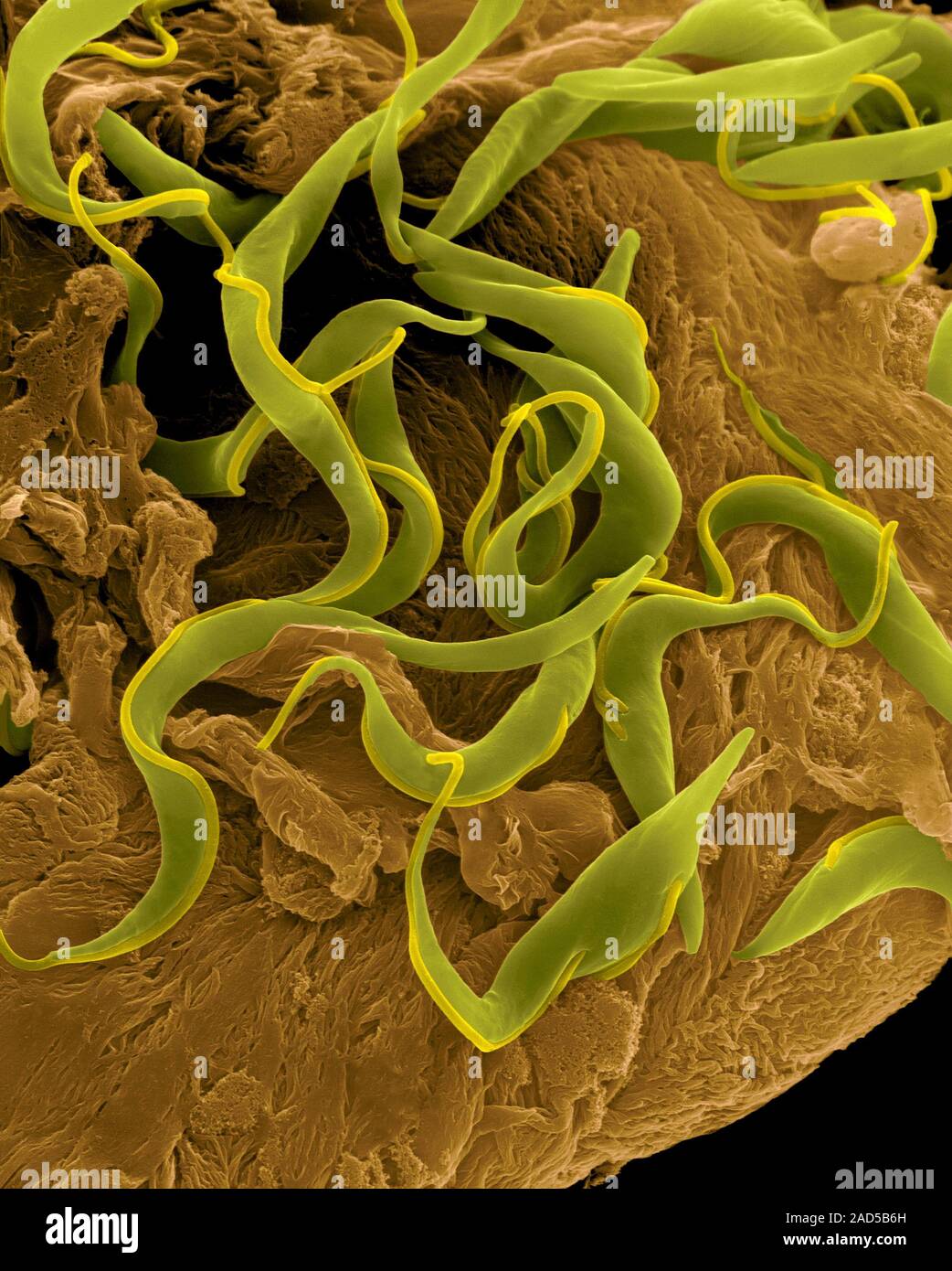 Trypanosome trypomastigote (Trypanosoma sp.), coloured scanning ...