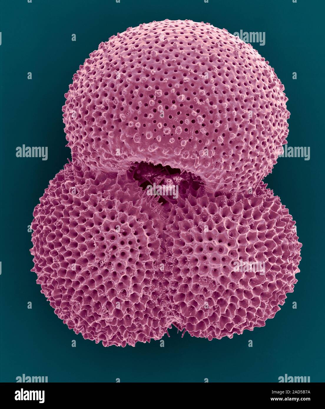 Planktonic foraminiferan (foram) test from the southern Caribbean ...