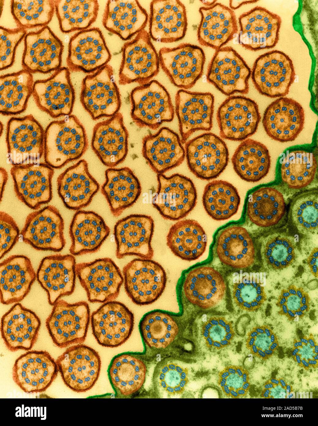 Ciliated fresh water protozoan (Paramecium multimicronucleatum ...