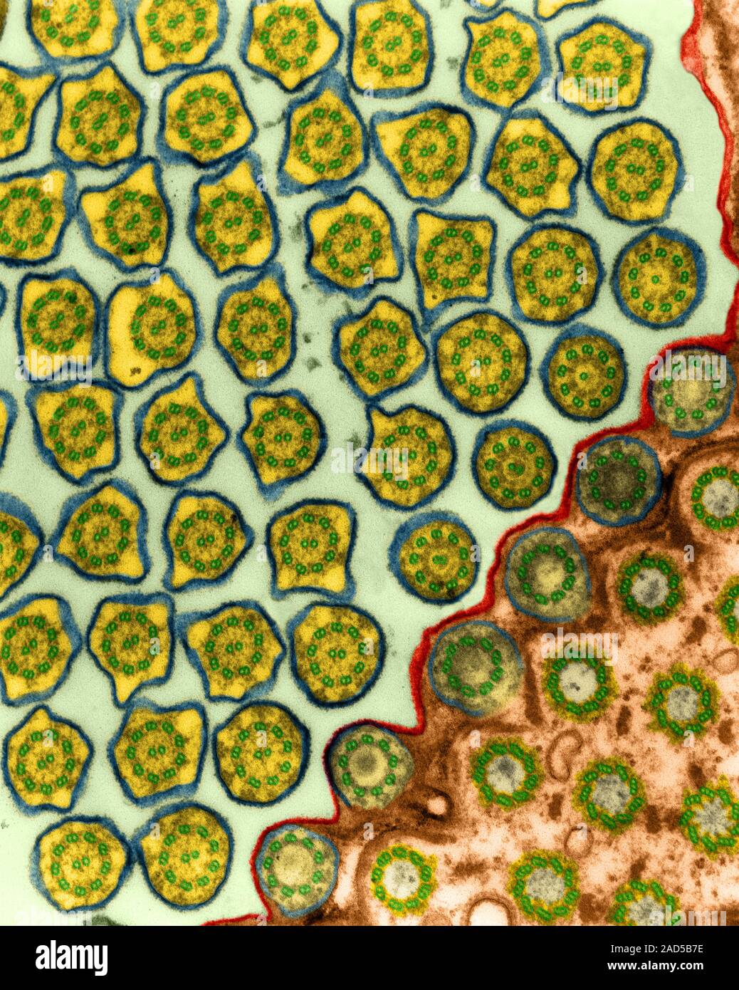 Ciliated fresh water protozoan (Paramecium multimicronucleatum ...