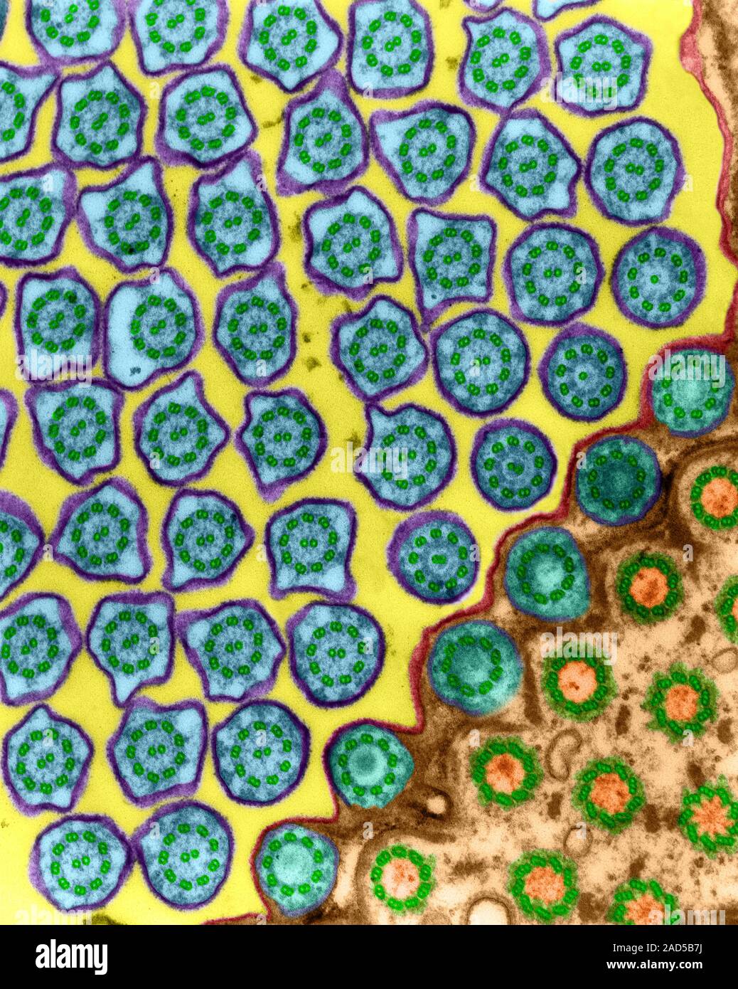 Ciliated fresh water protozoan (Paramecium multimicronucleatum), coloured transmission electron ...