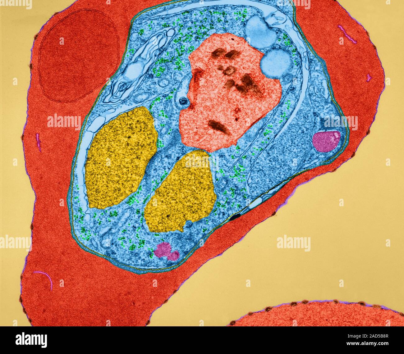 Plasmodium falciparum plasmodial young schizont infecting an ...