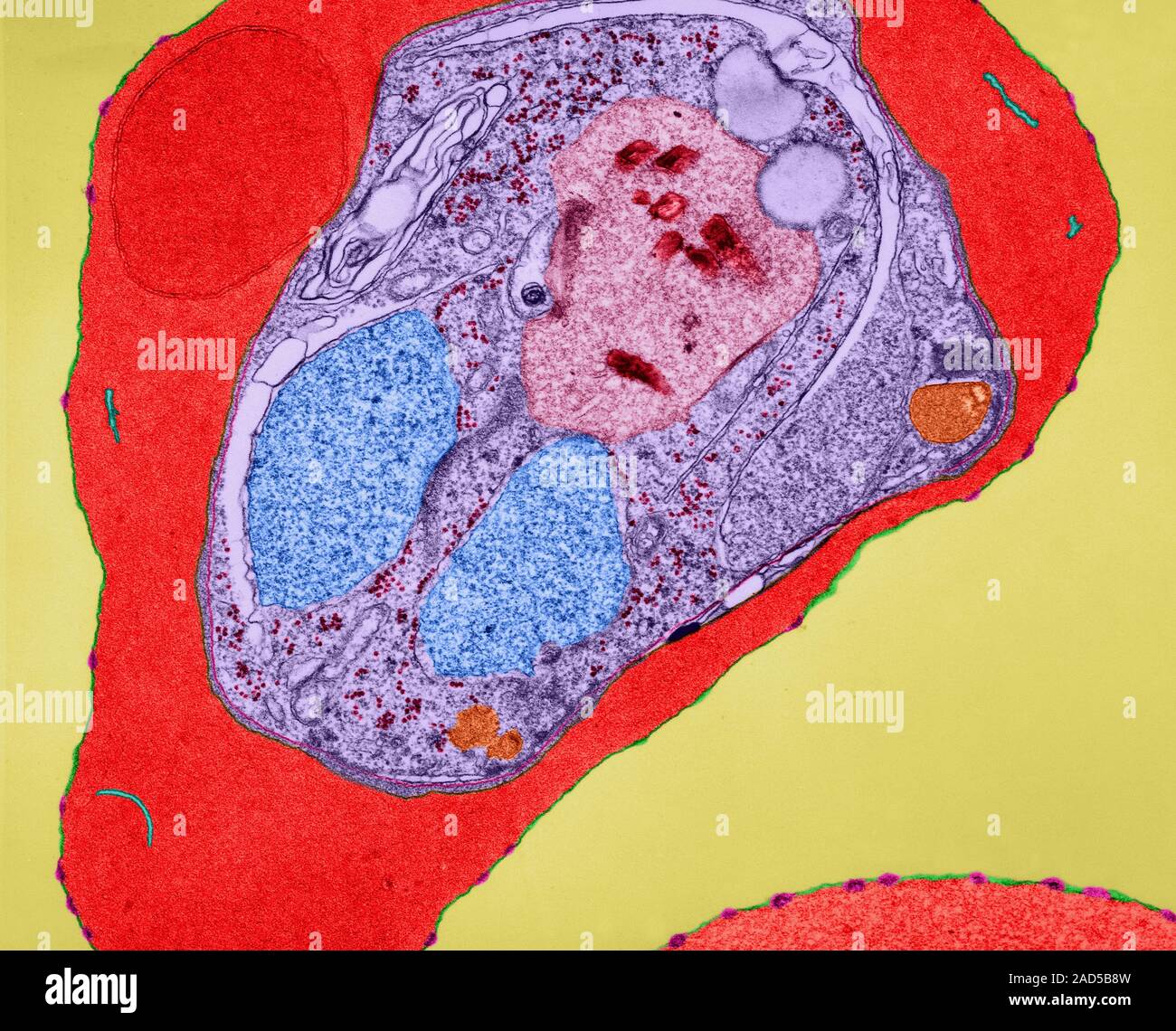 Plasmodium falciparum plasmodial young schizont infecting an ...