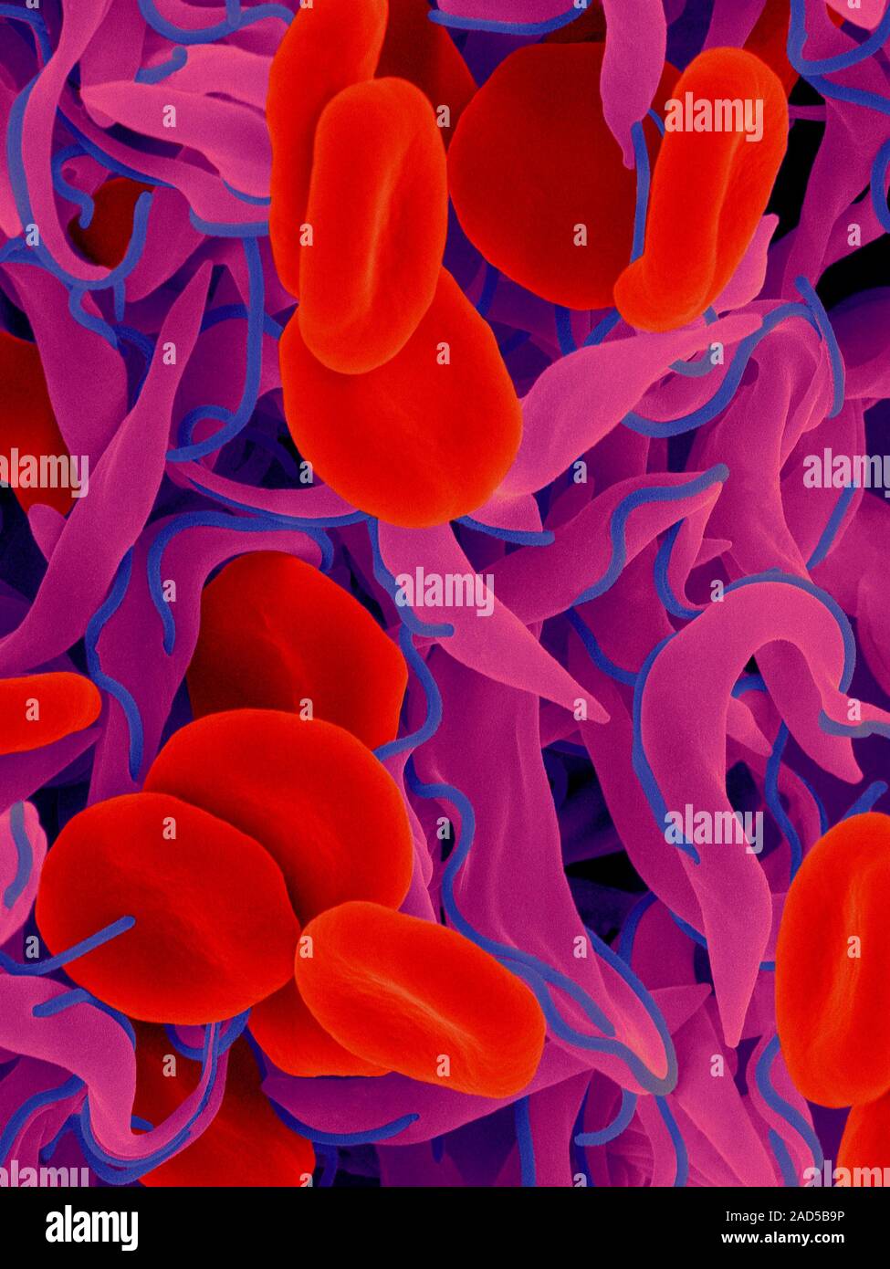 Trypanosome trypomastigotes (Trypanosoma sp.), coloured scanning ...