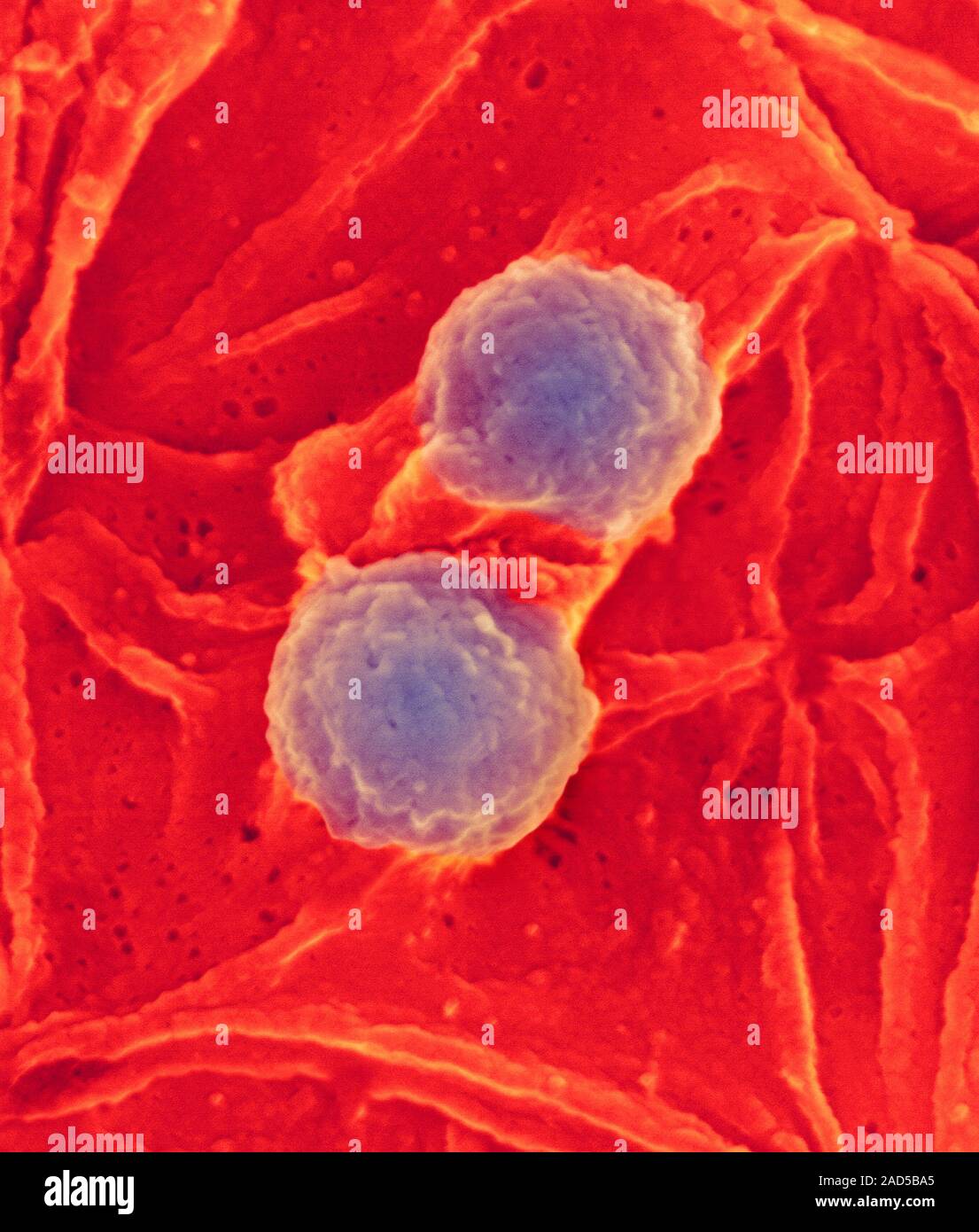 Plasmodium falciparum ring stage inside lysed red blood cell ...