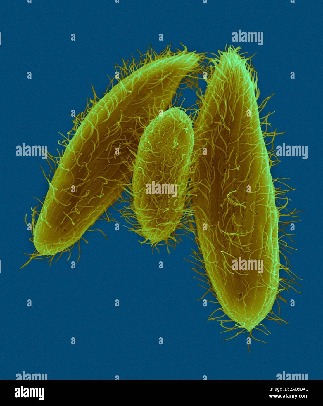 Ciliated protozoan (Tetrahymena vorax), coloured scanning electron ...