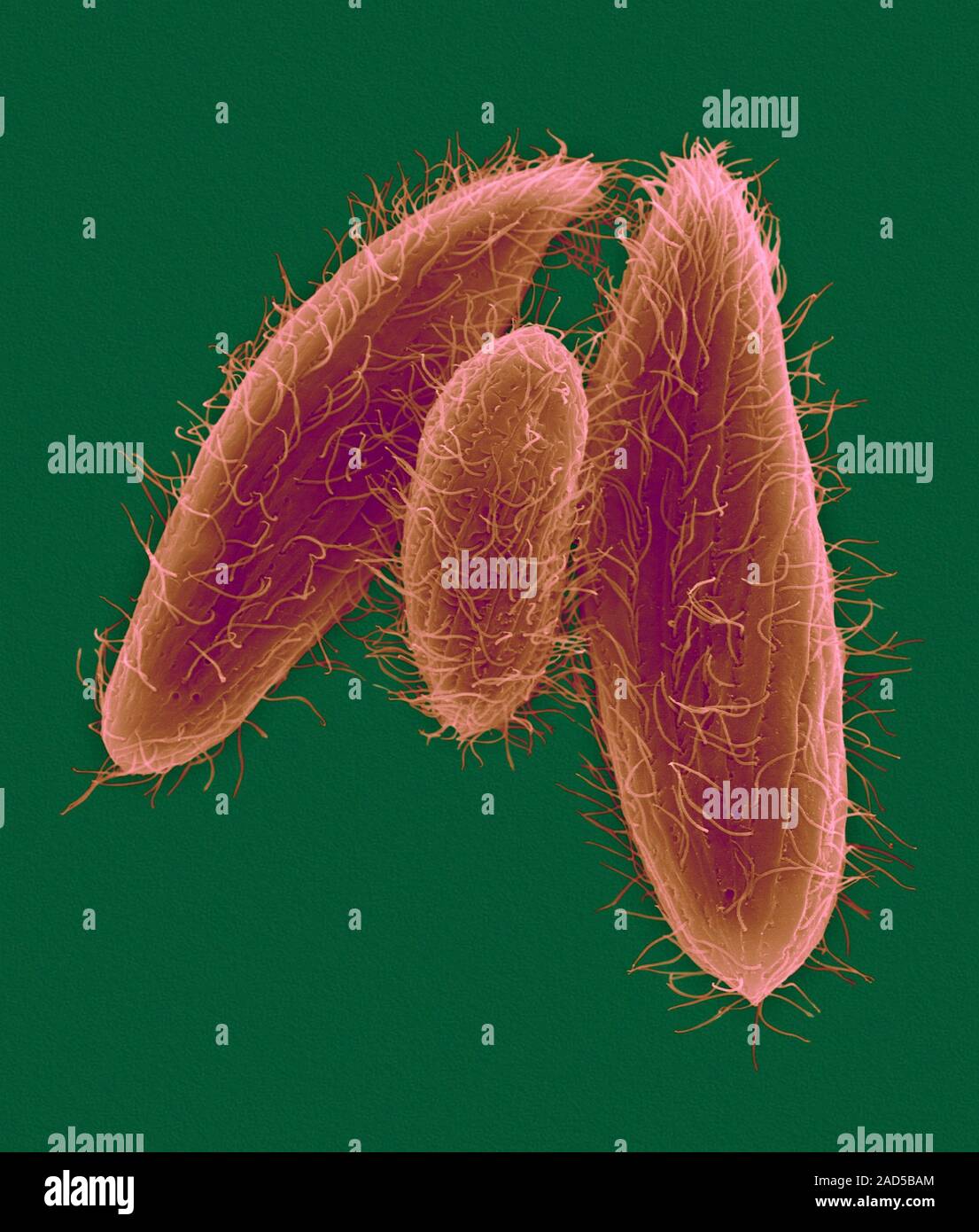 Ciliated protozoan (Tetrahymena vorax), coloured scanning electron ... Ciliated protozoan (Tetrahymena vorax), coloured scanning electron ...