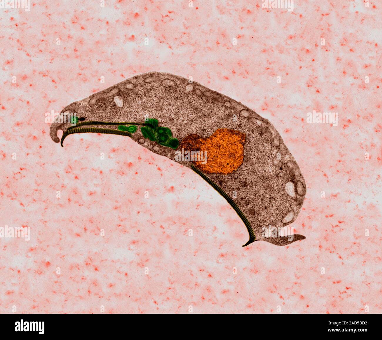 Giardia sp., protozoan that causes the protozoal intestinal infection ...