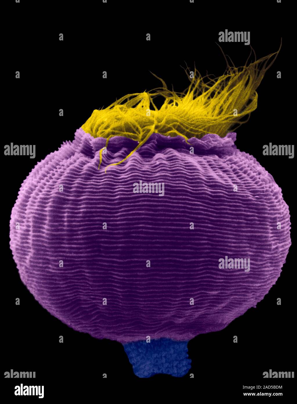 Vorticella sp., ciliated protozoan, coloured scanning electron ... Vorticella sp., ciliated protozoan, coloured scanning electron ...