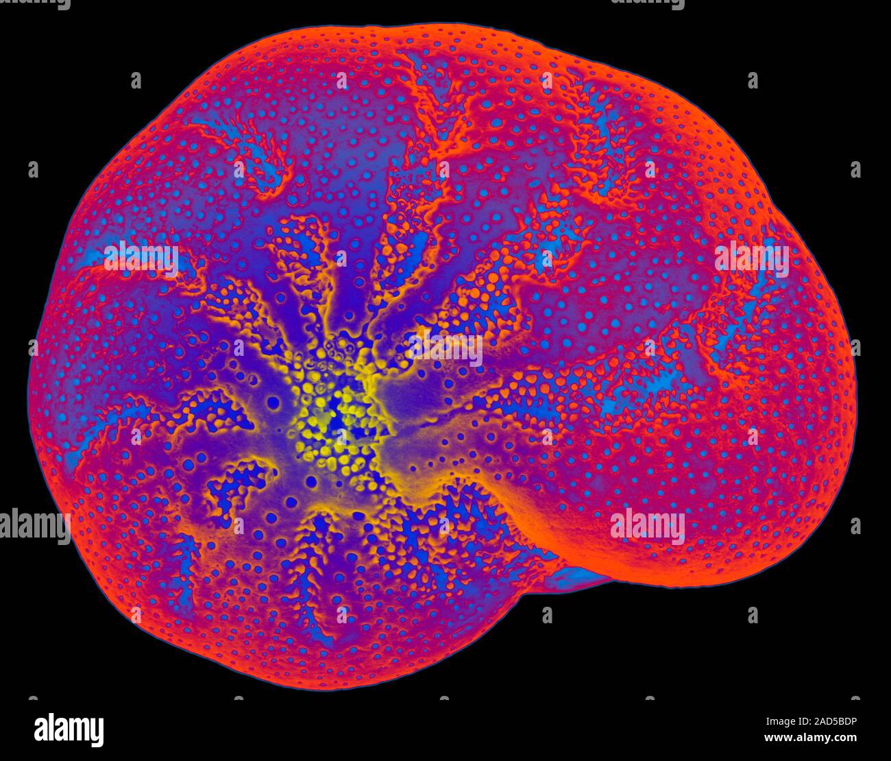 Foraminiferan test (Elphidium sp.), coloured scanning electron ...