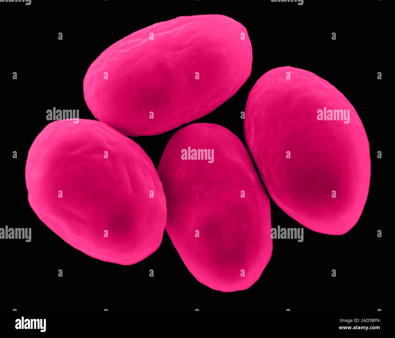 Giardia lamblia, a protozoan (cyst stage) found in water contaminated ...