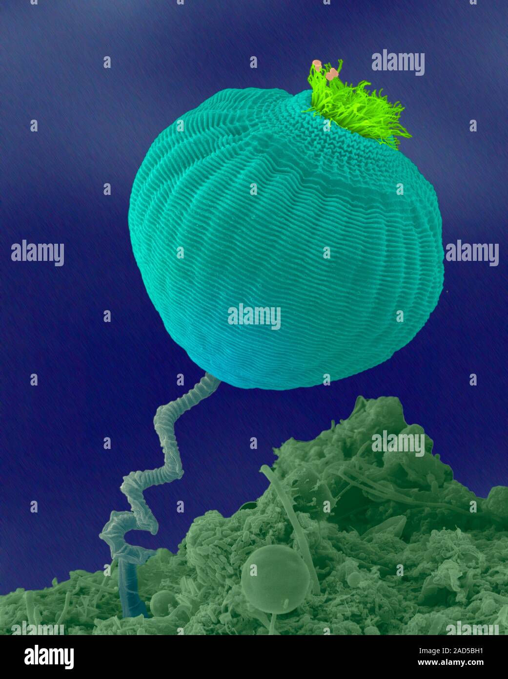 Vorticella sp., ciliated protozoan, coloured scanning electron ...