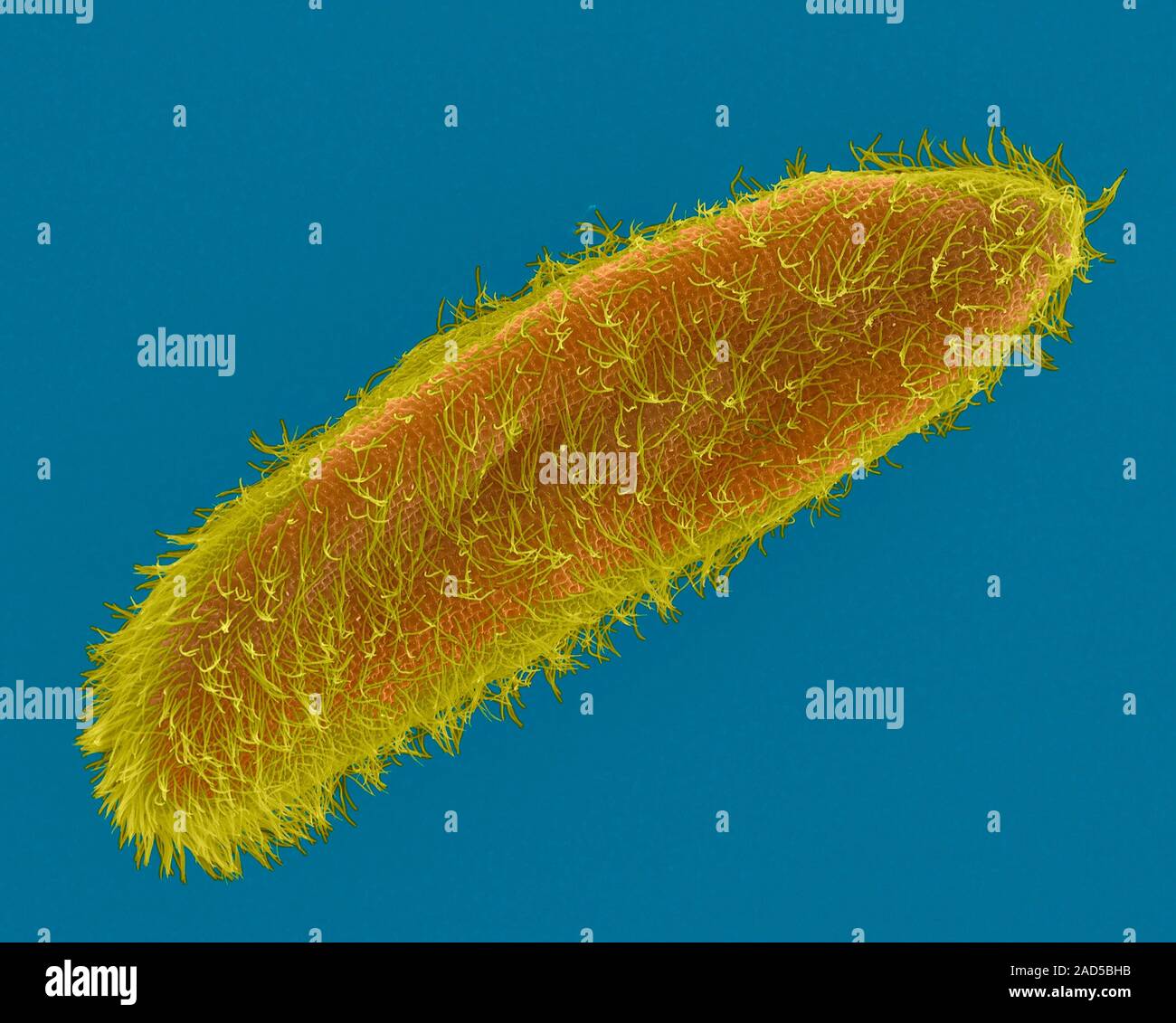 Ciliated protozoan, Paramecium multimicronucleatum, coloured scanning ...