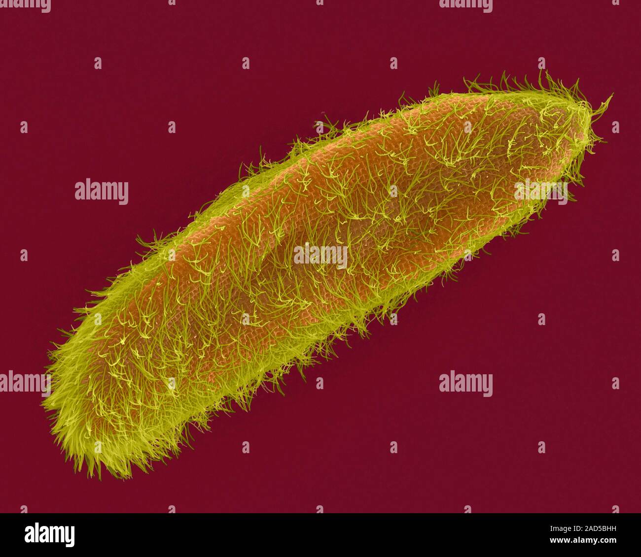 Ciliated protozoan, Paramecium multimicronucleatum, coloured scanning ...