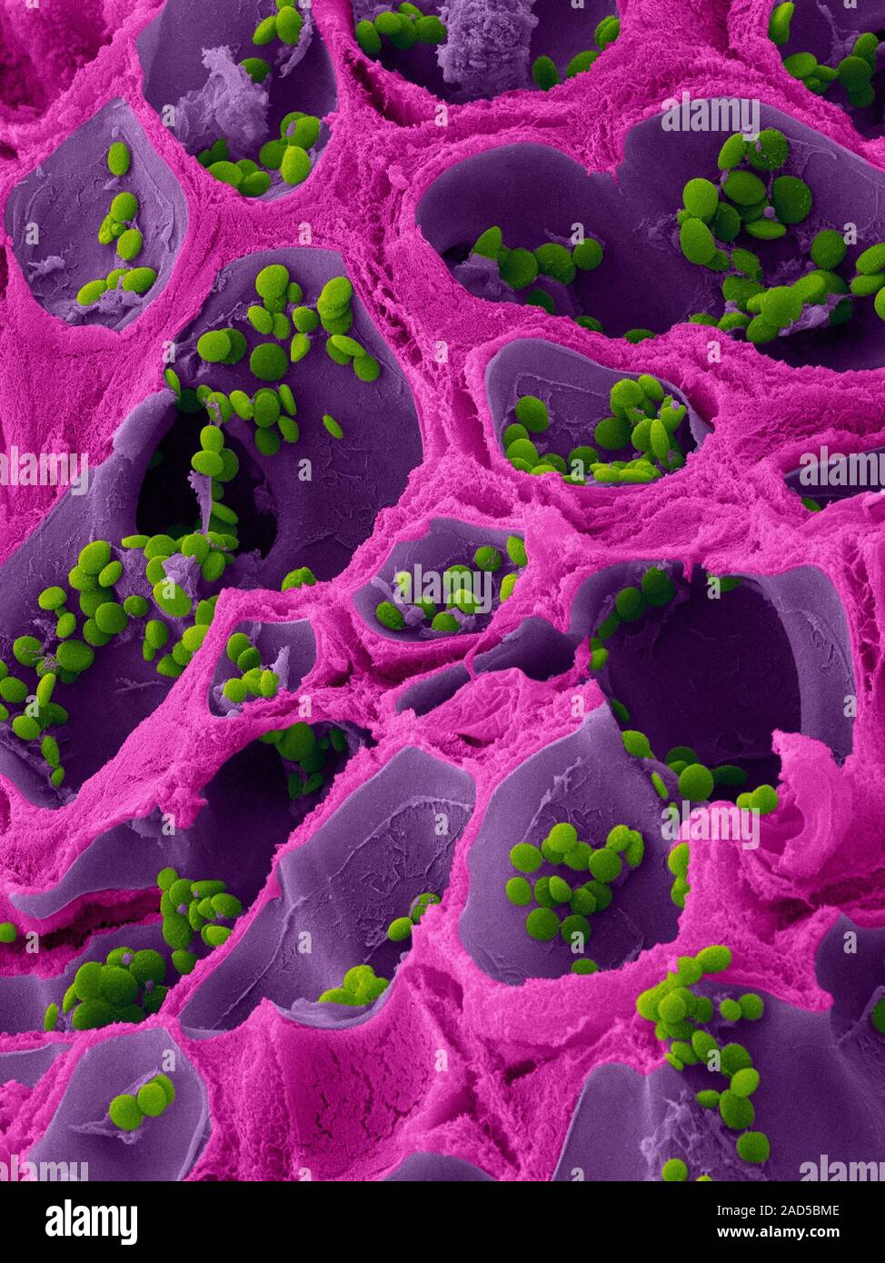 Coloured scanning electron micrograph (SEM) of coralline red alga ...