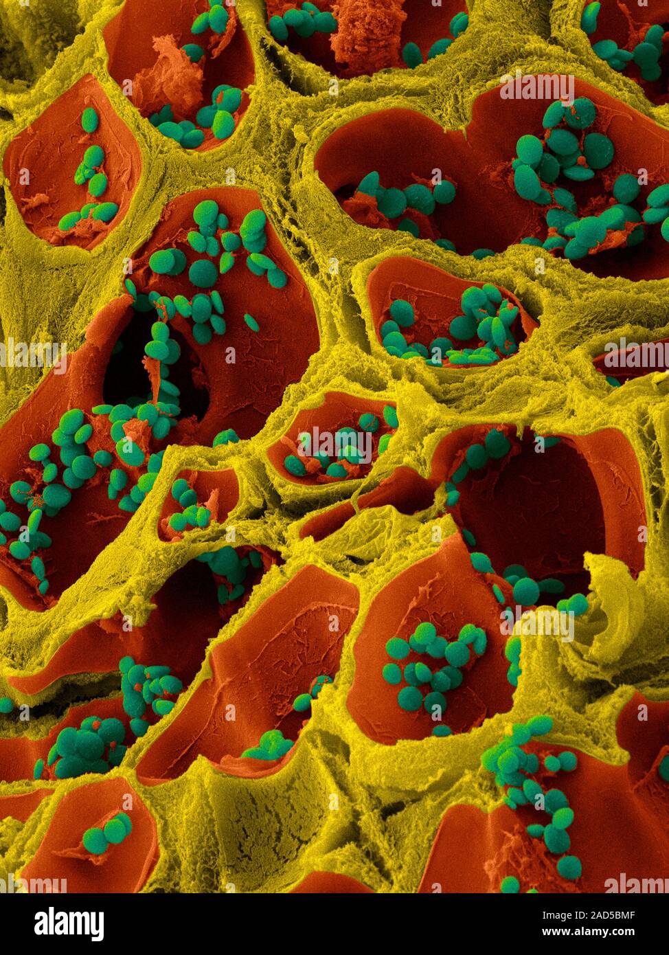 Coloured scanning electron micrograph (SEM) of coralline red alga ...